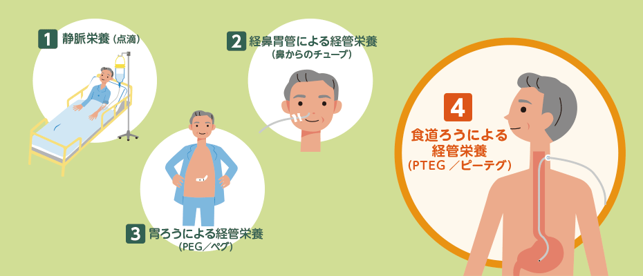 PTEGとは | 住友ベークライト株式会社